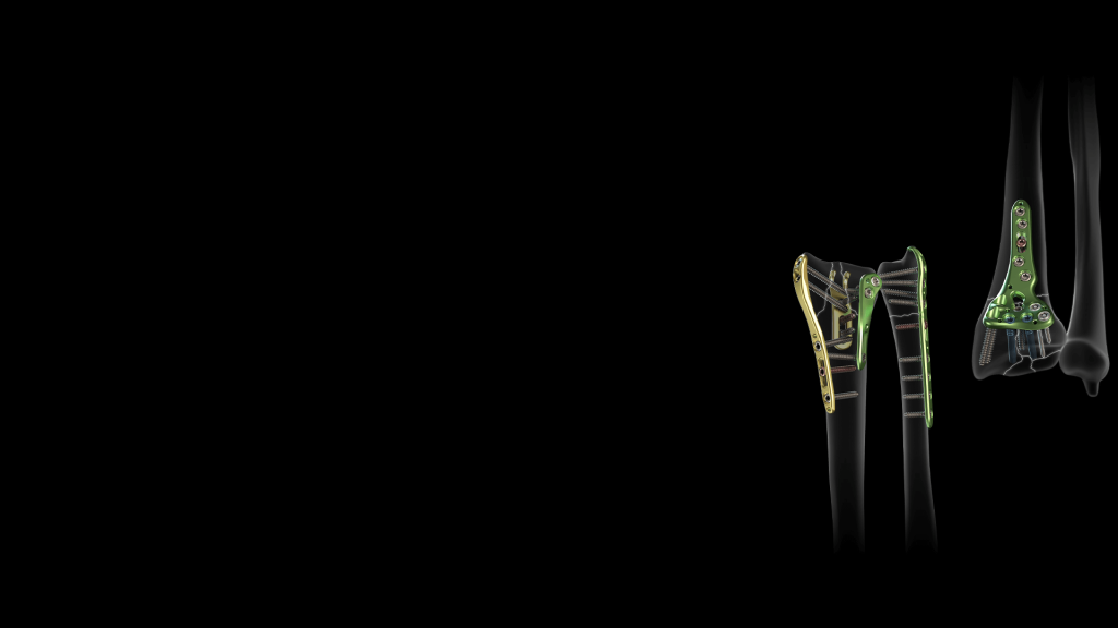 Upper Limb. - Newclip Technics